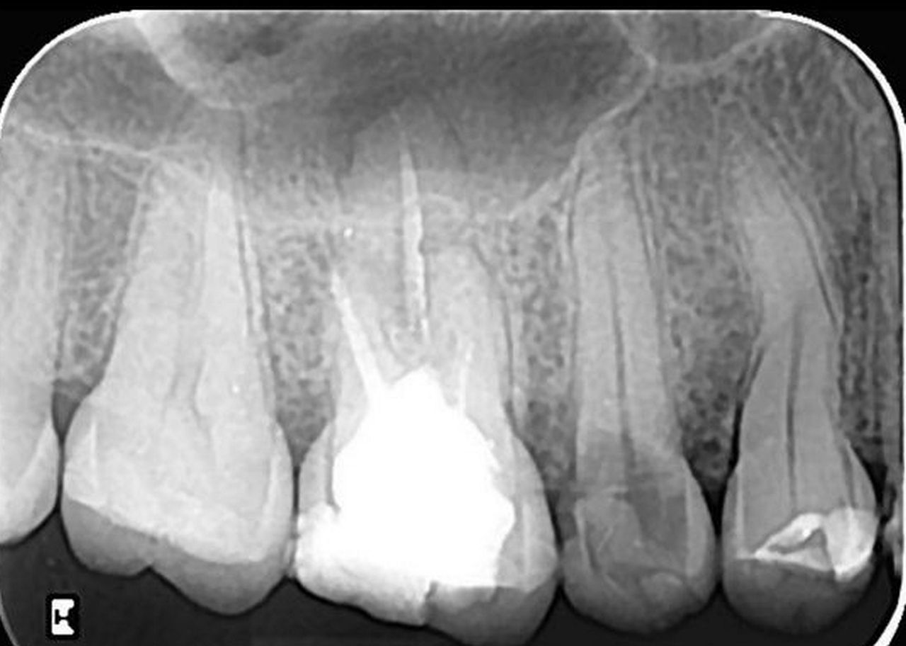 RTG kabinet za snimanje zuba od ponedjeljka radi cijeli dan - DubrovnikNet